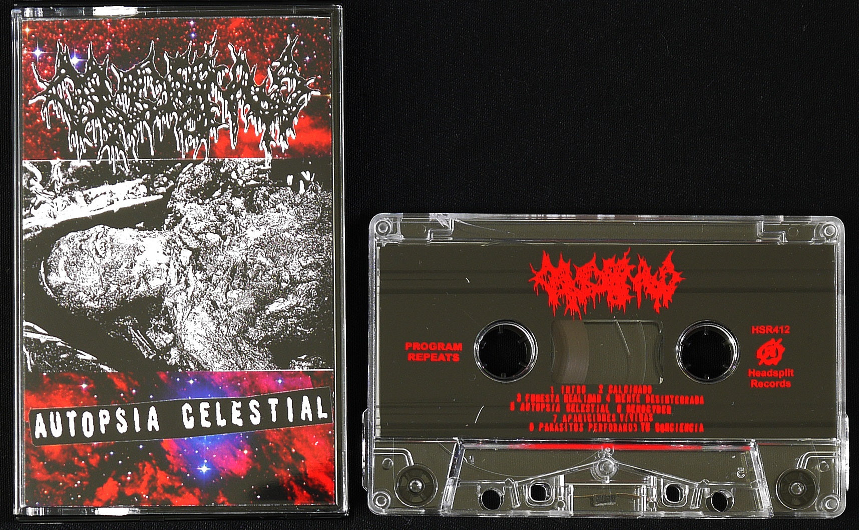 CALCINADO - Autopsia Celestial MC Tape – grindfather.prod