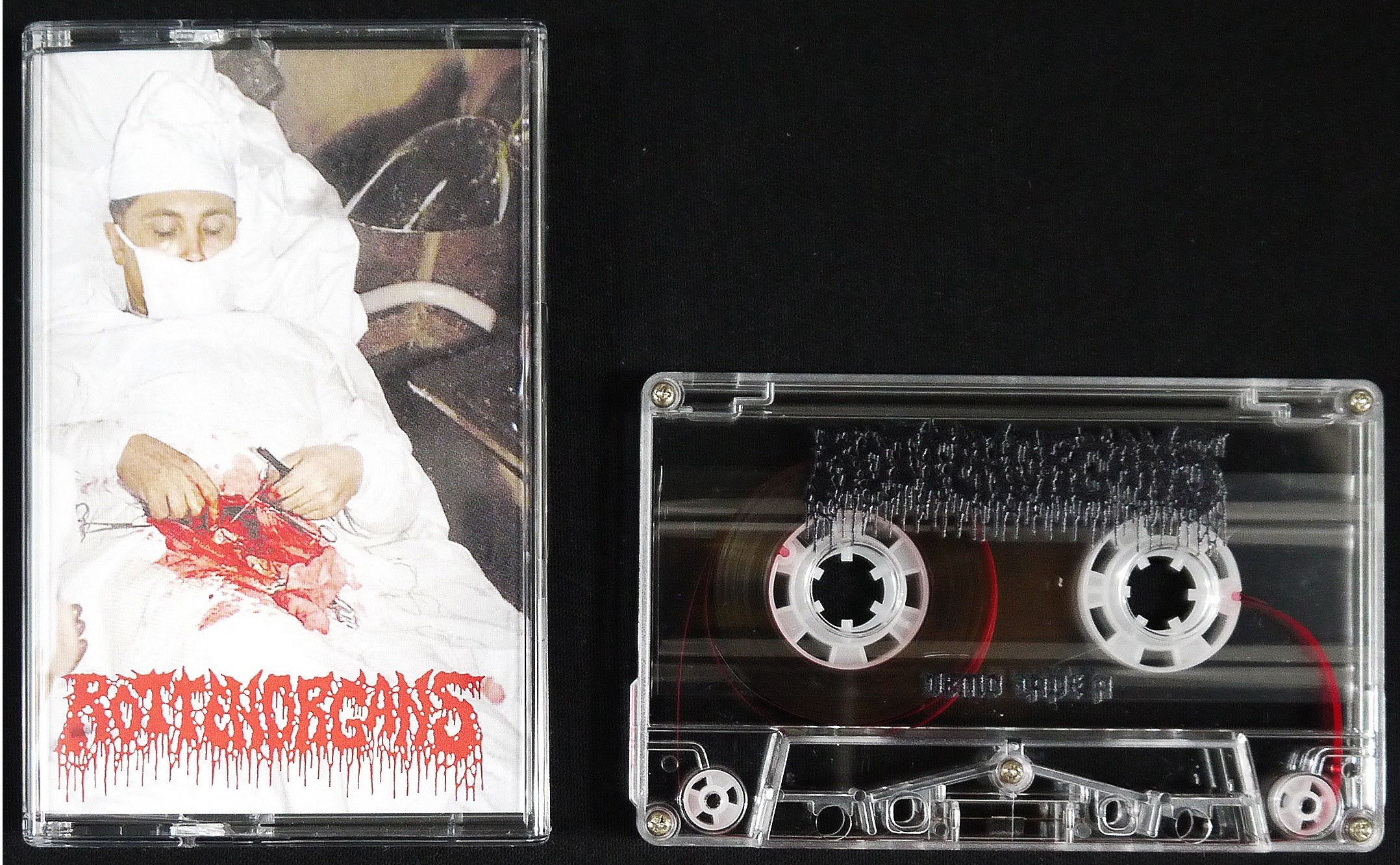 ROTTEN ORGANS - Demo MC Tape – grindfather.prod