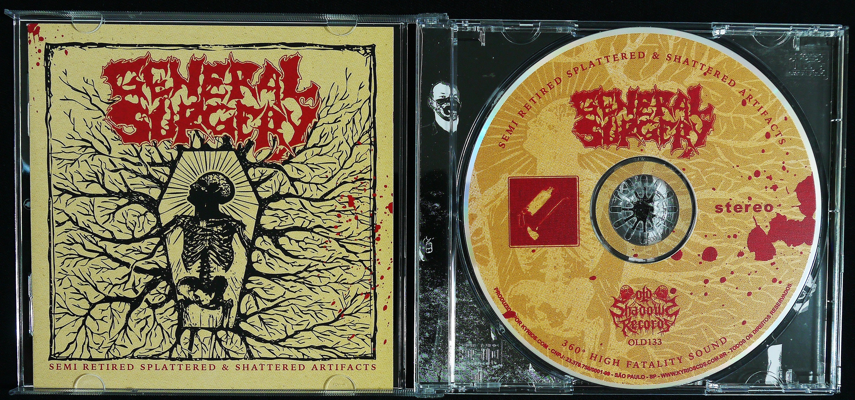GENERAL SURGERY - Semi Retired Splattered & Shattered Artifacts CD ...